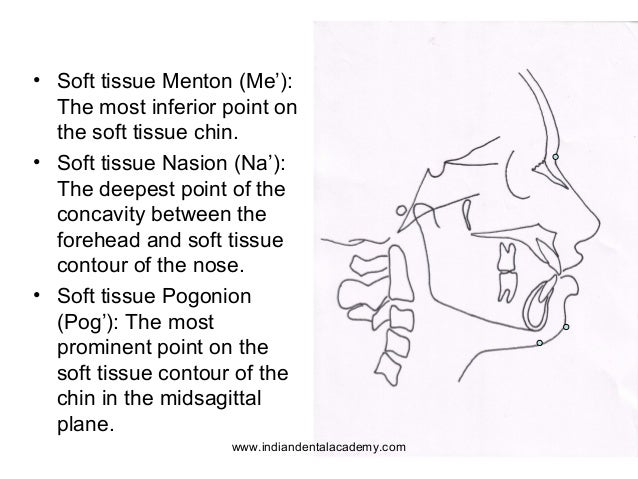 Cephalometrics introdction basics