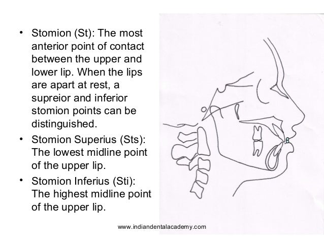 Cephalometrics introdction basics