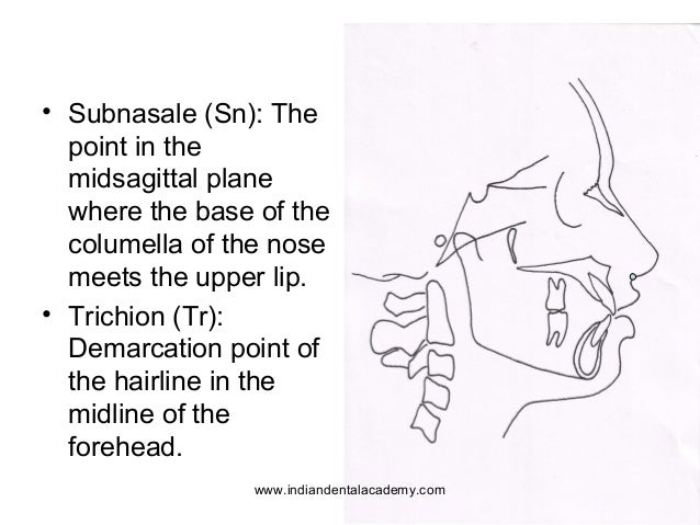 Cephalometrics introdction basics