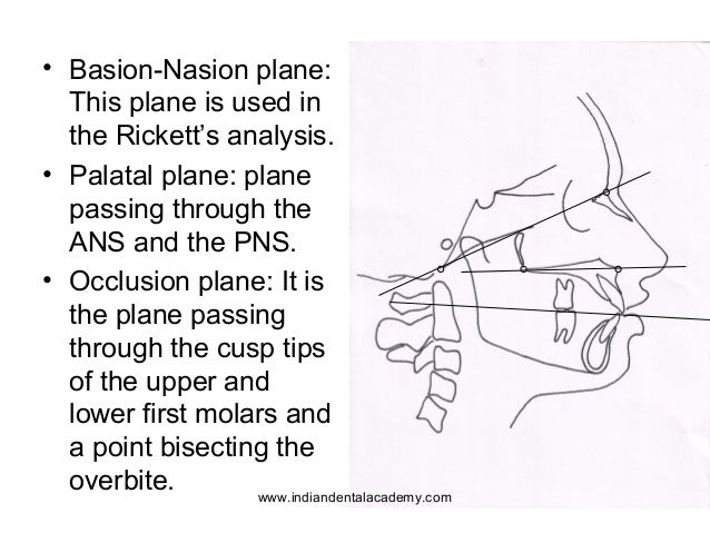 Cephalometrics introdction basics