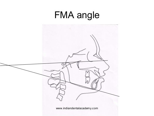 Cephalometrics introdction basics