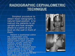 Ceph landmarks | PPT