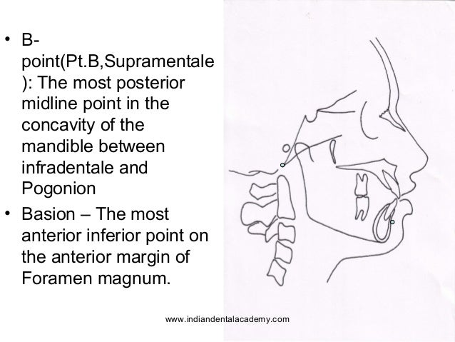 Cephalometrics for orthodontics