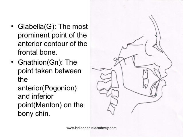 Cephalometrics for orthodontics