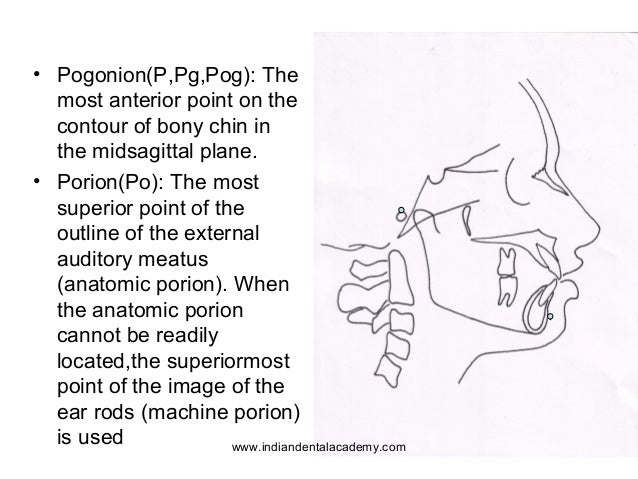Cephalometrics for orthodontics