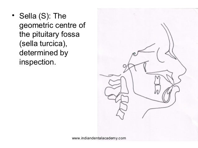 Cephalometrics for orthodontics