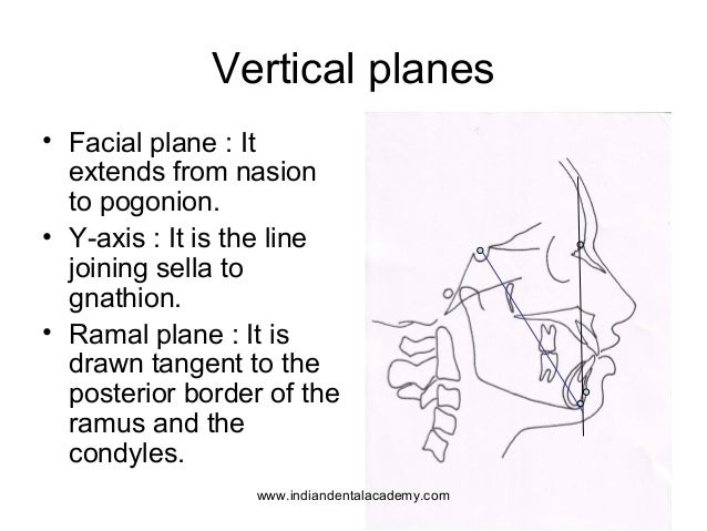 Cephalometrics for orthodontics