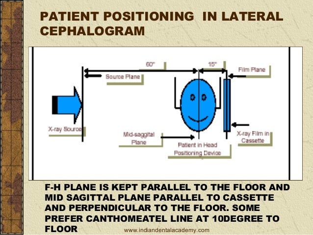 Cephalometrics