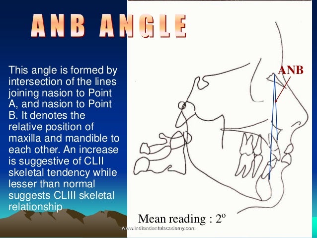 Cephalometrics in orthodontics/certified fixed orthodontic courses by…