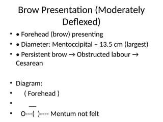 Cephalic_Presentations_Diagram_Based.pptx
