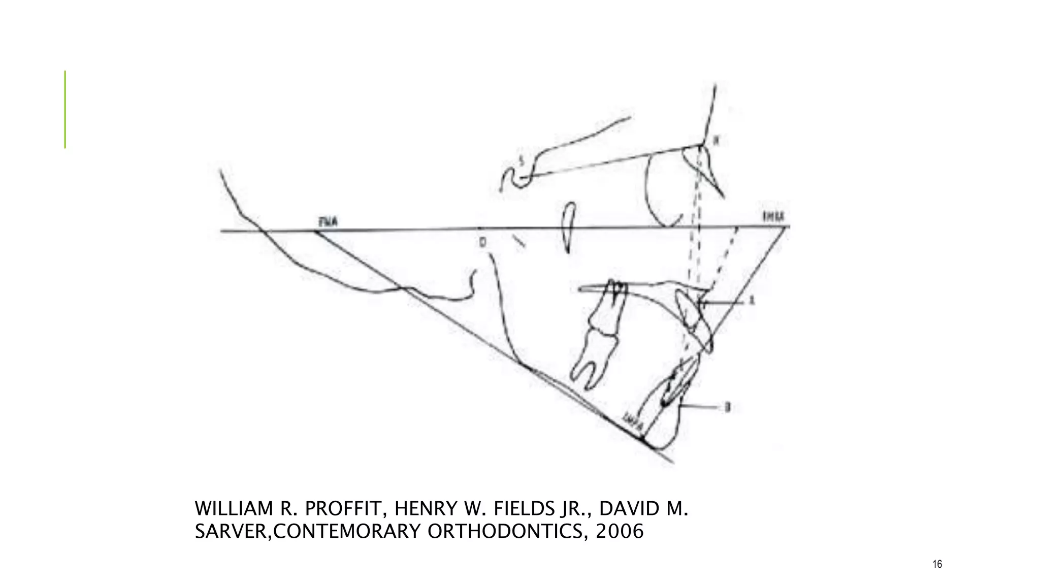 CEPHALOMETRY PART 2 | PPTX | Dental Health | Diseases and Conditions