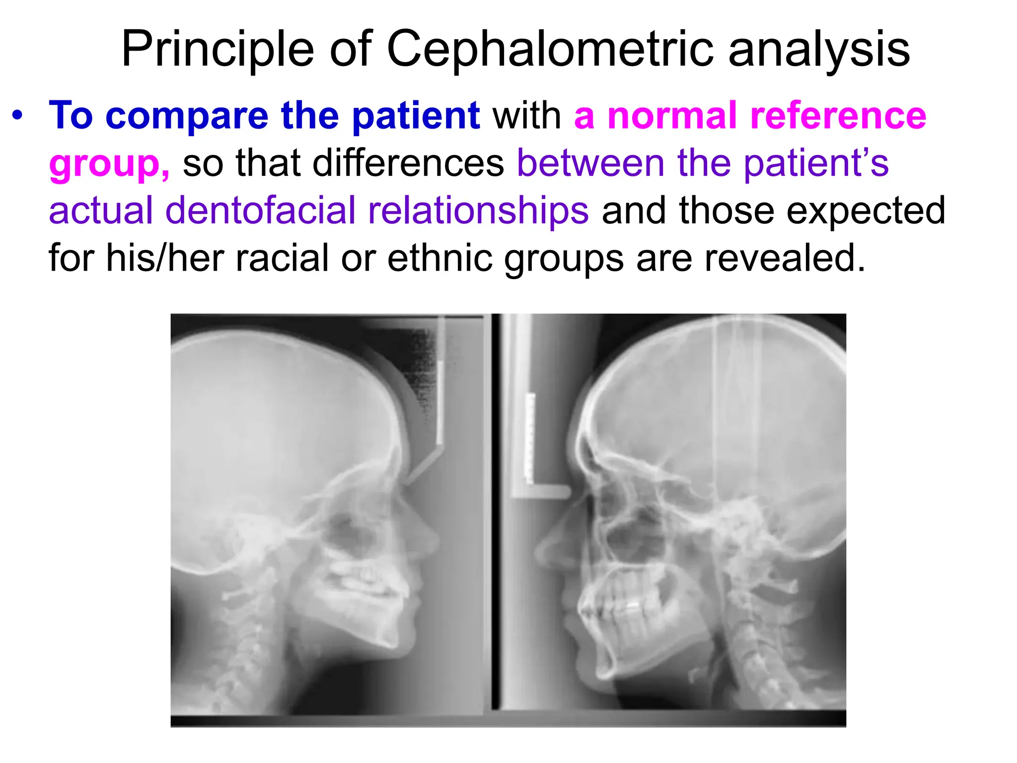 Cephalometric-Analysis.pptx