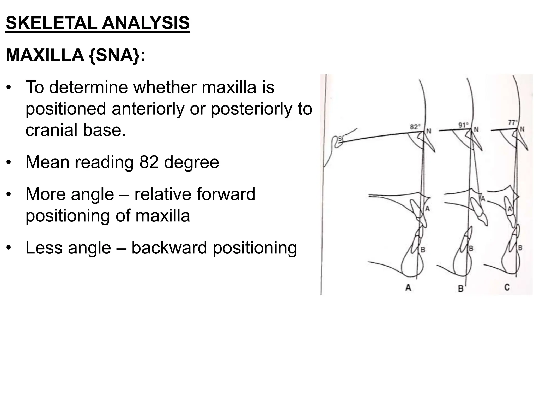 Cephalometric-Analysis.pptx