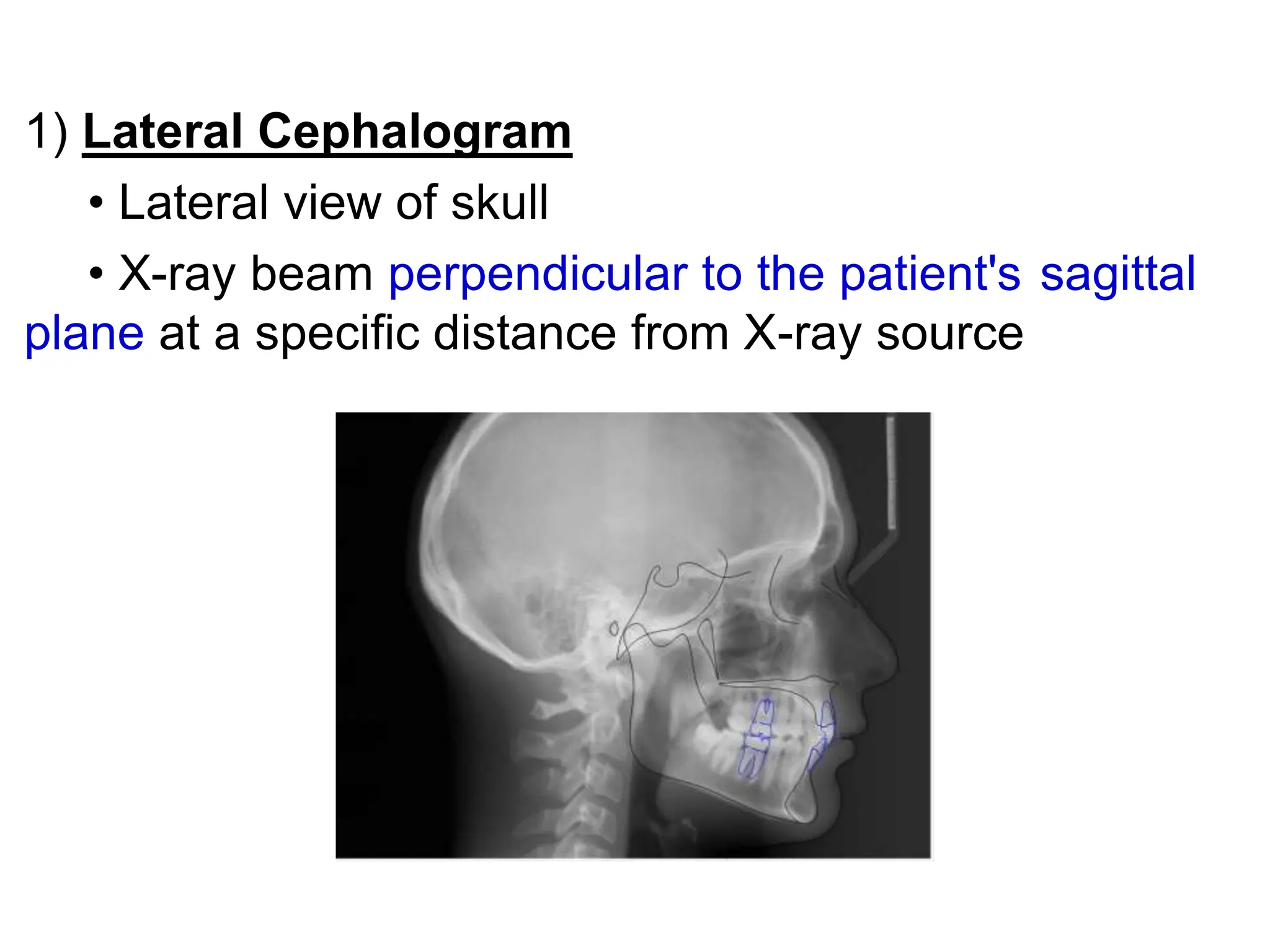 Cephalometric-Analysis.pptx