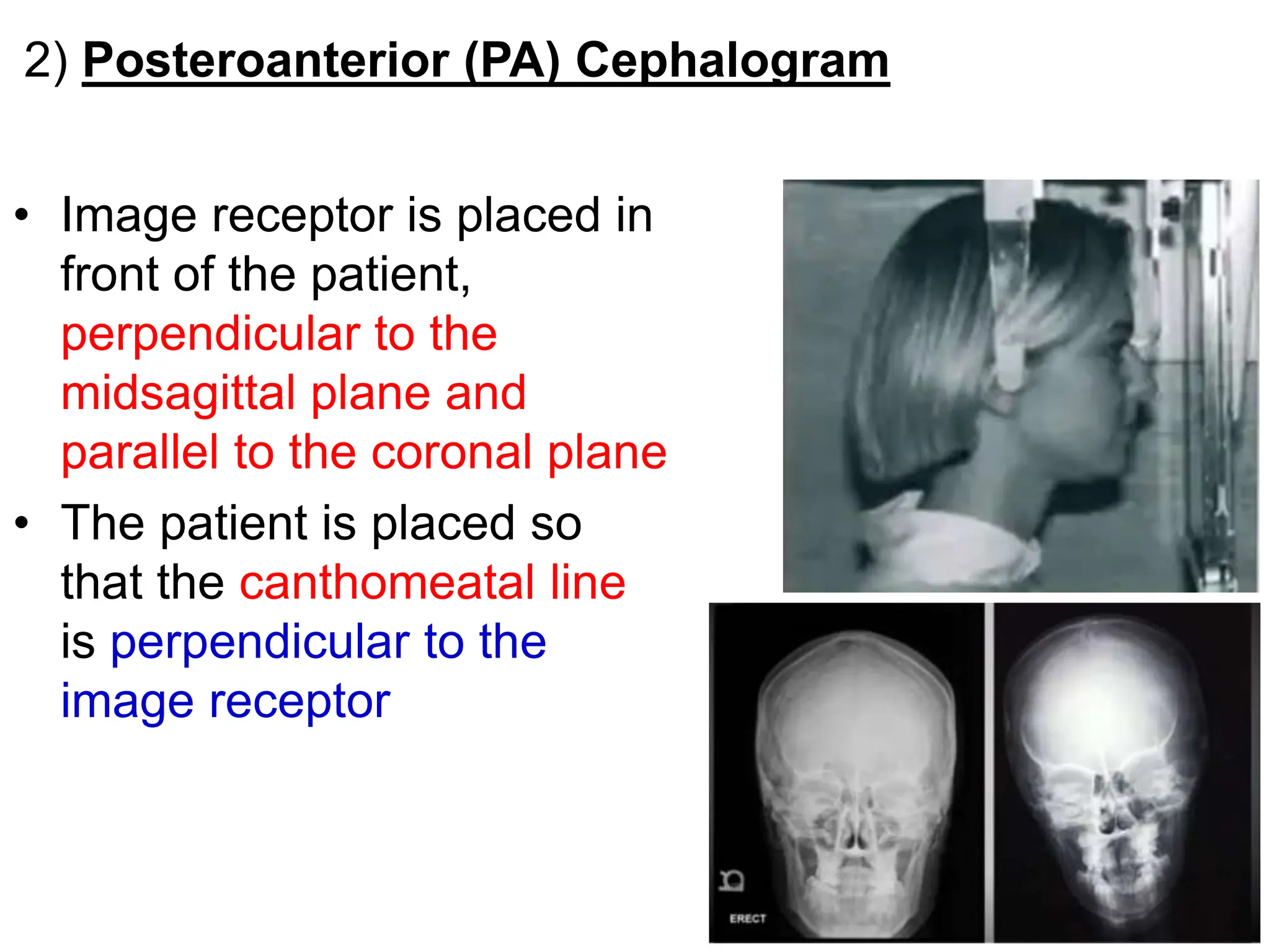 Cephalometric-Analysis.pptx