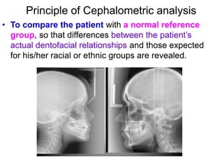 Cephalometric-Analysis.pptx