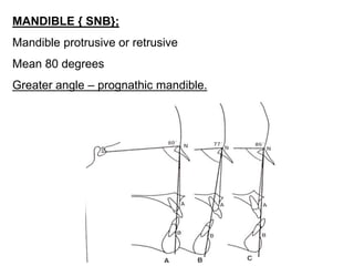 Cephalometric-Analysis.pptx