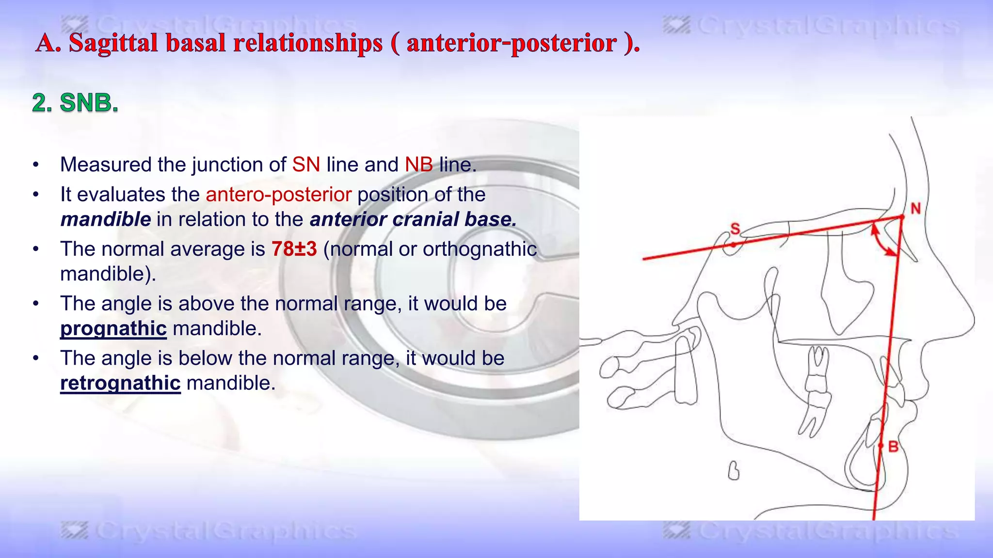 Cephalometric analysis | PPTX