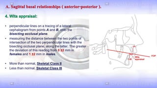 Cephalometric analysis | PPTX