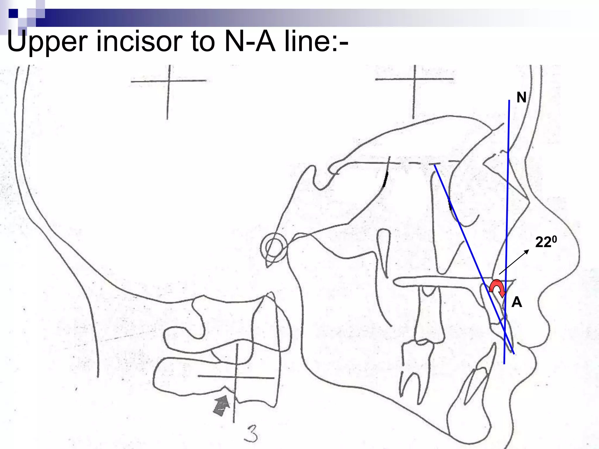 CEPHALOMETRIC ANALYSIS.ppt