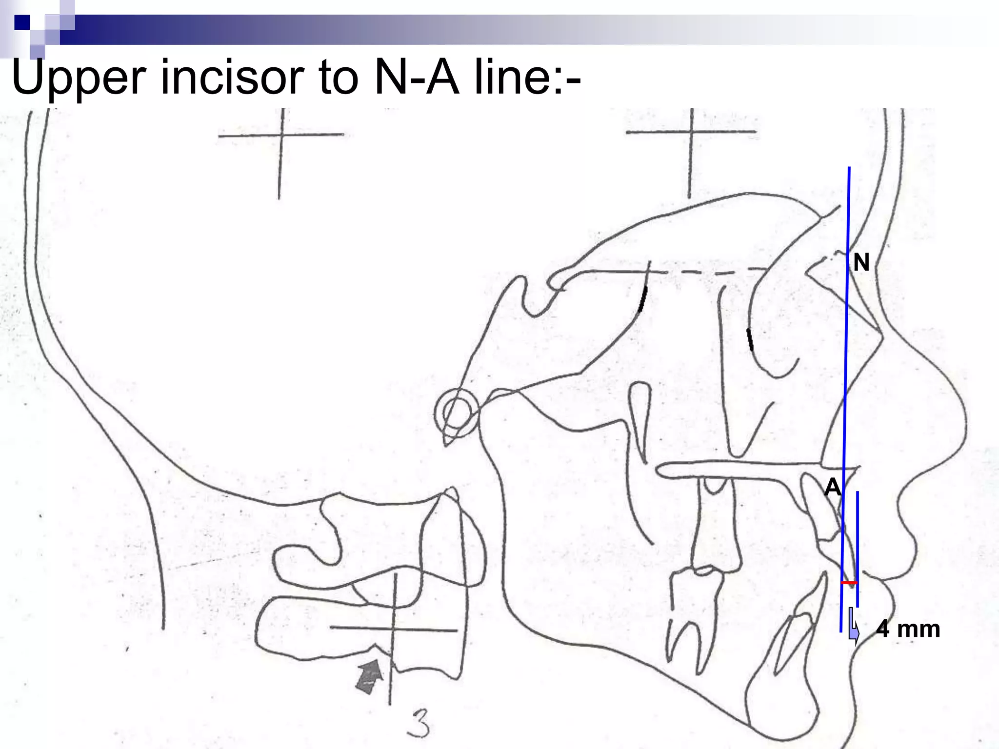 CEPHALOMETRIC ANALYSIS.ppt
