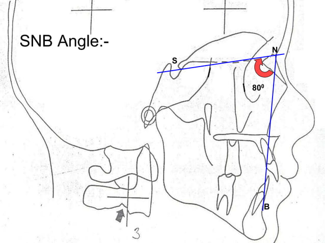 CEPHALOMETRIC ANALYSIS.ppt