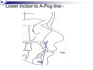 CEPHALOMETRIC ANALYSIS.ppt
