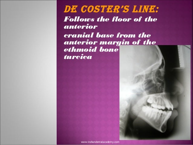 Cephalometric analysis (1)
