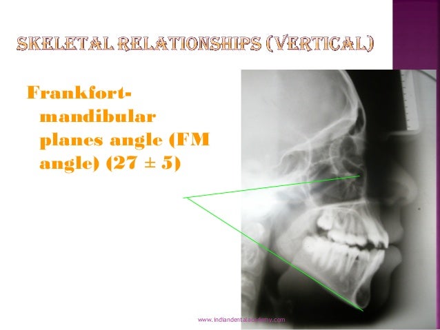 Cephalometric analysis (1)