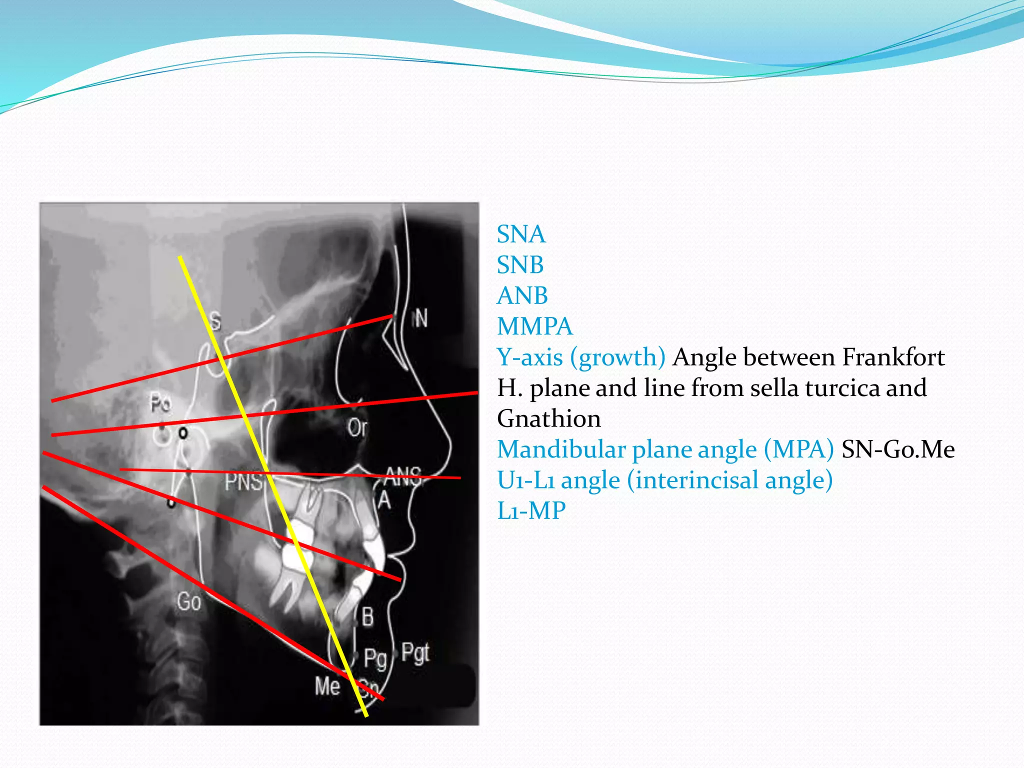Orthodontic Cephalometric analysis | PPTX