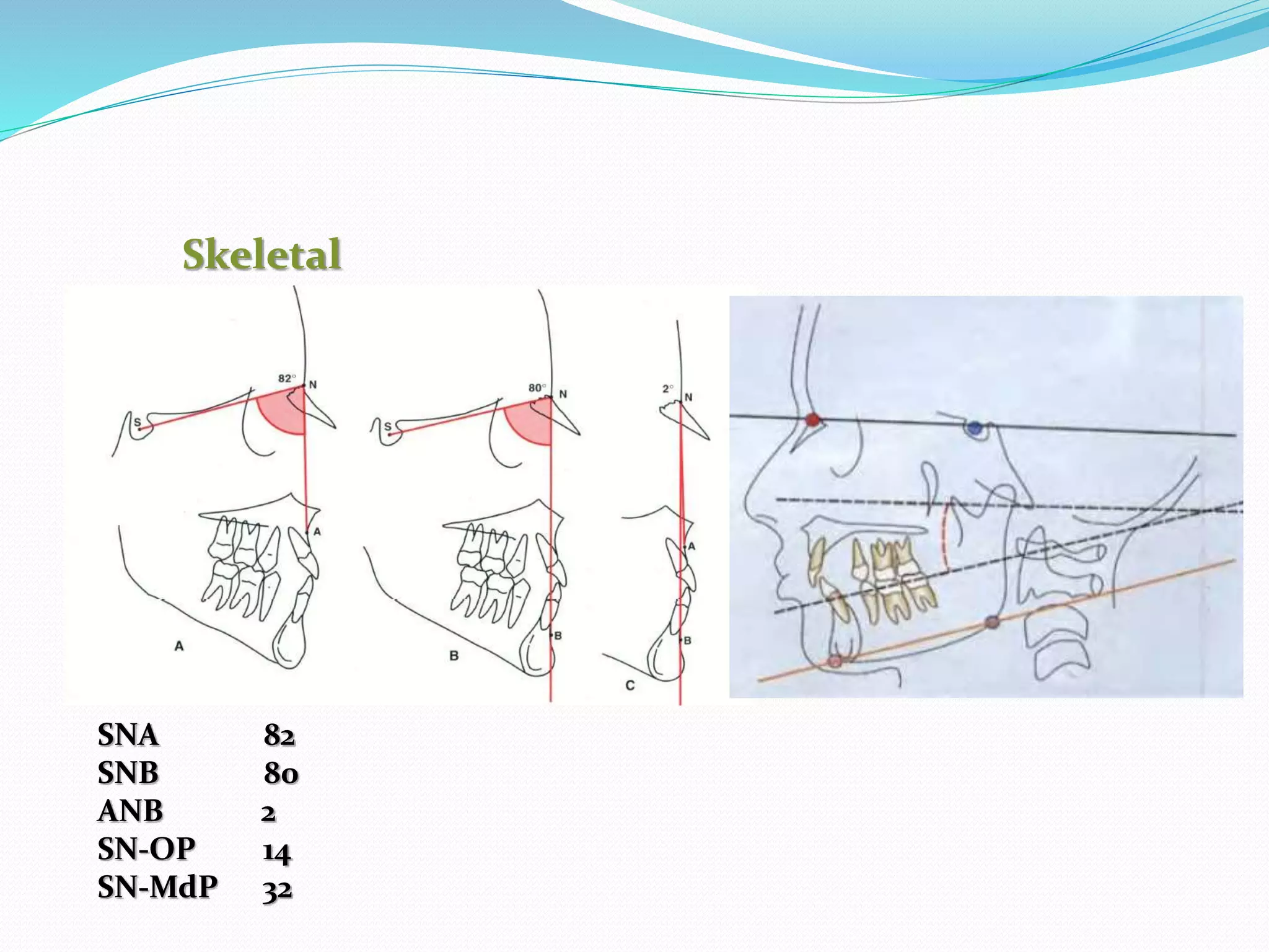 Orthodontic Cephalometric analysis | PPTX