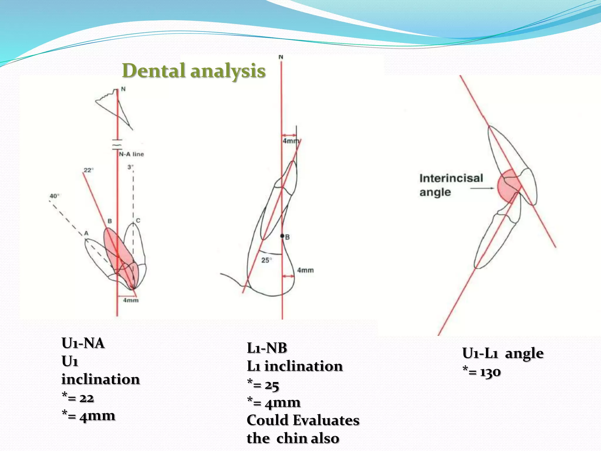 Orthodontic Cephalometric analysis | PPTX