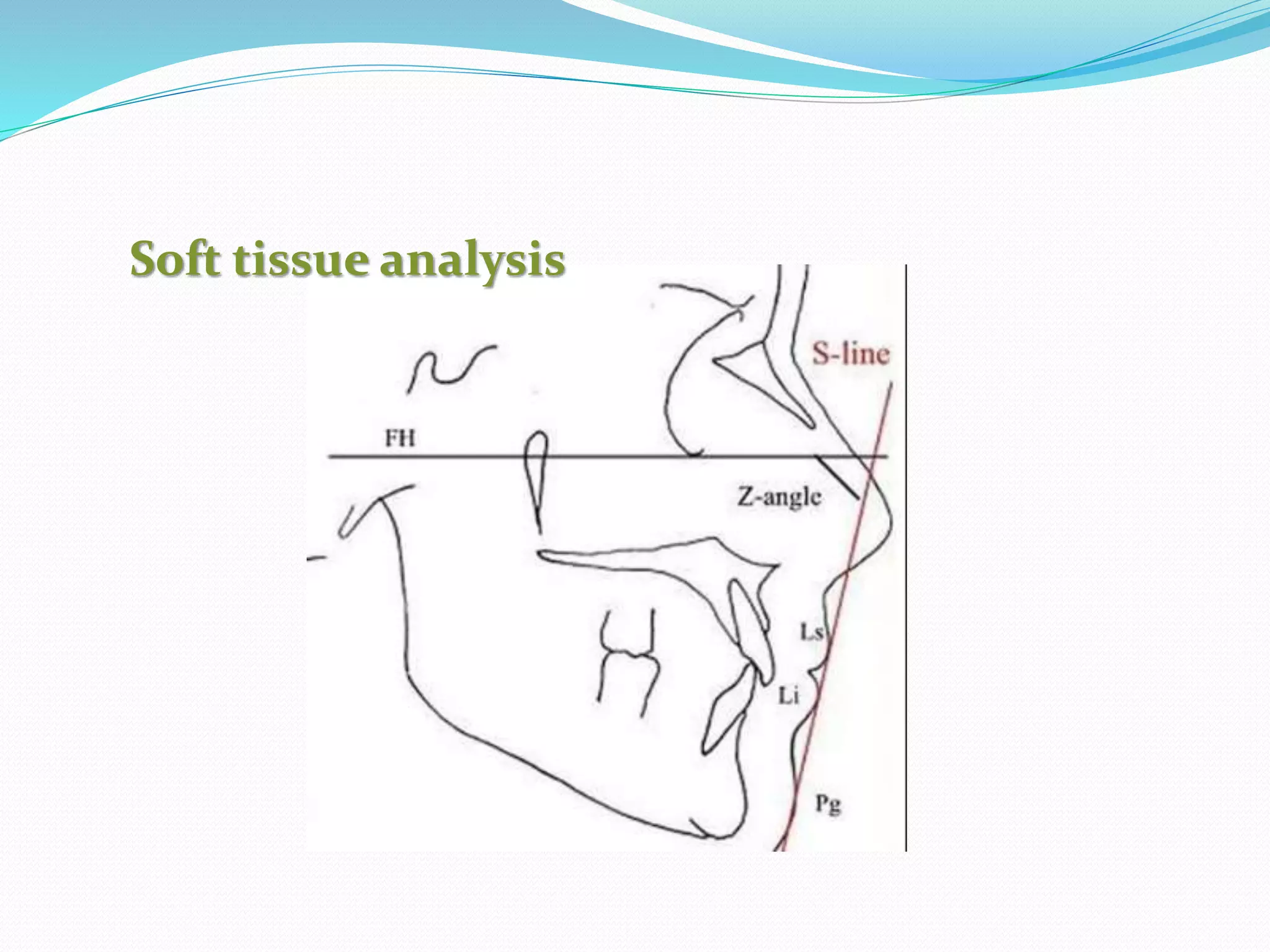 Orthodontic Cephalometric analysis | PPTX