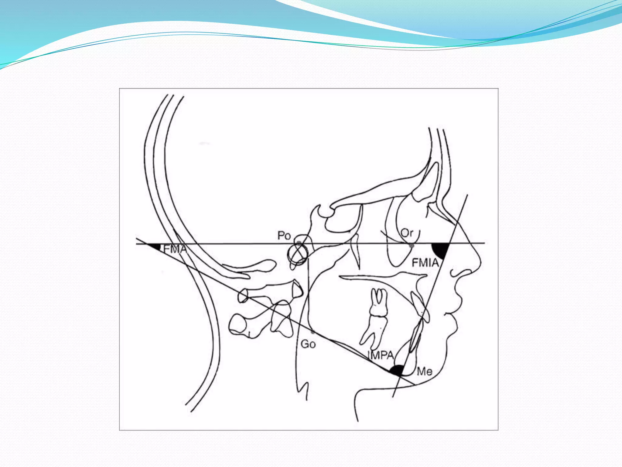 Orthodontic Cephalometric analysis | PPTX