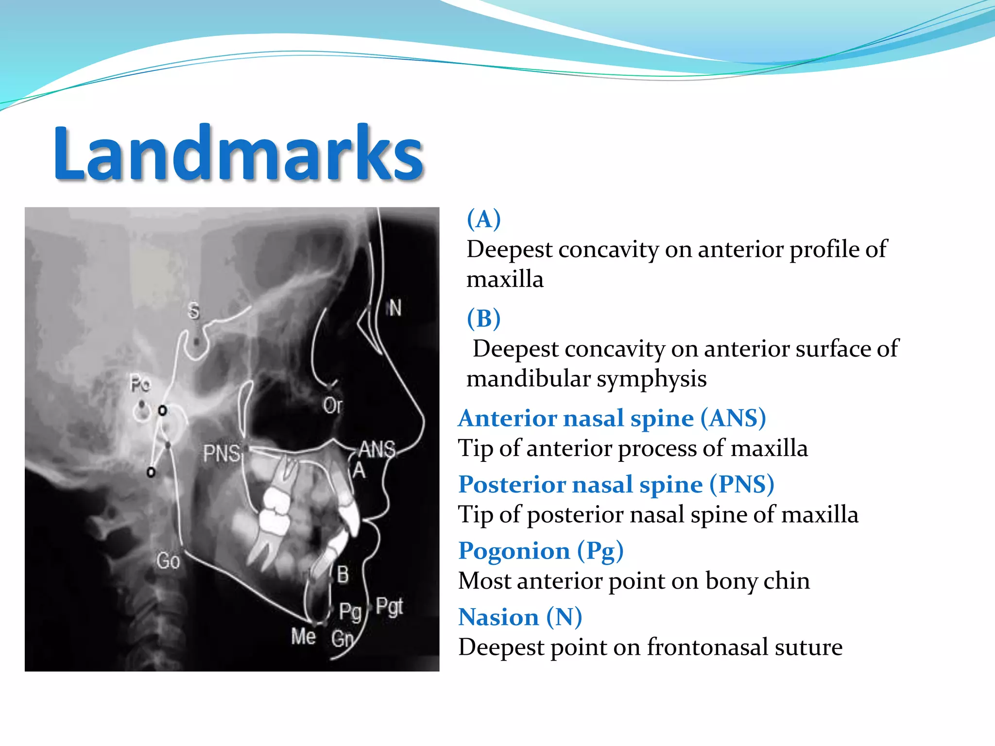 Orthodontic Cephalometric analysis | PPTX