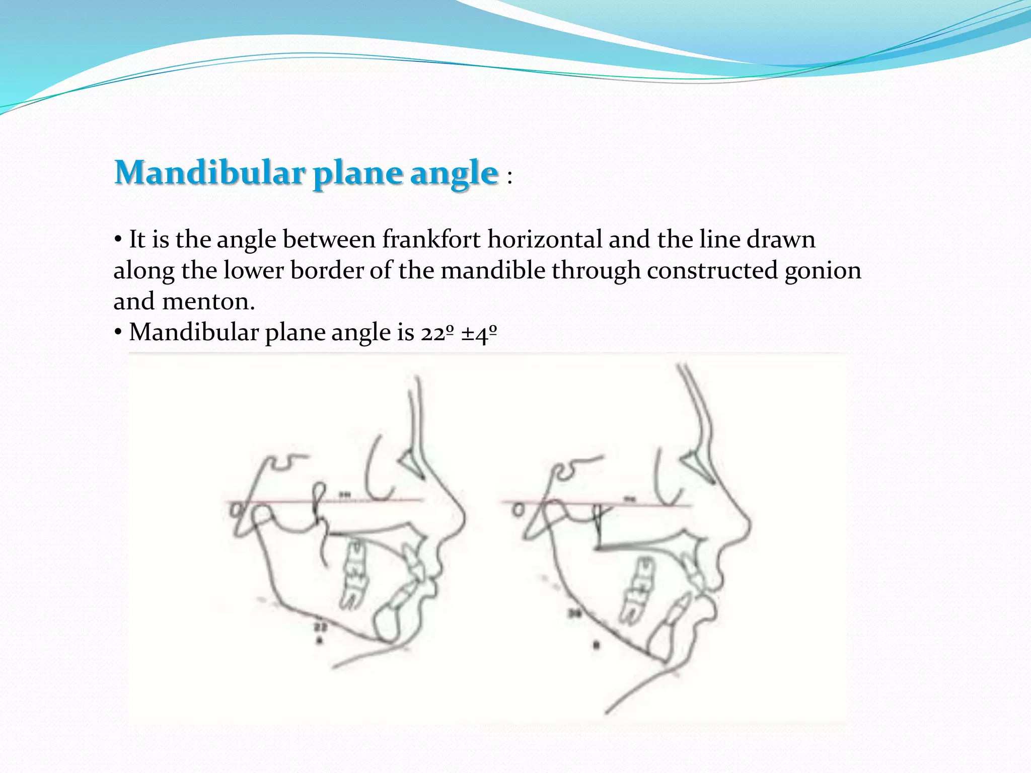 Orthodontic Cephalometric analysis | PPTX