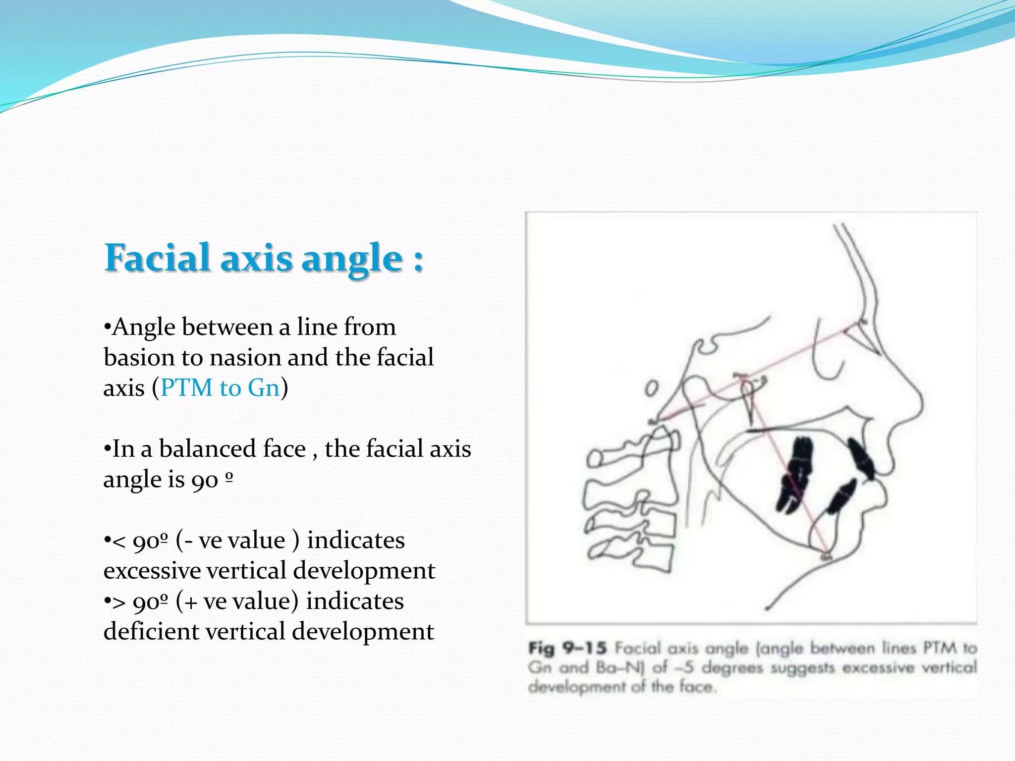 Orthodontic Cephalometric analysis | PPTX