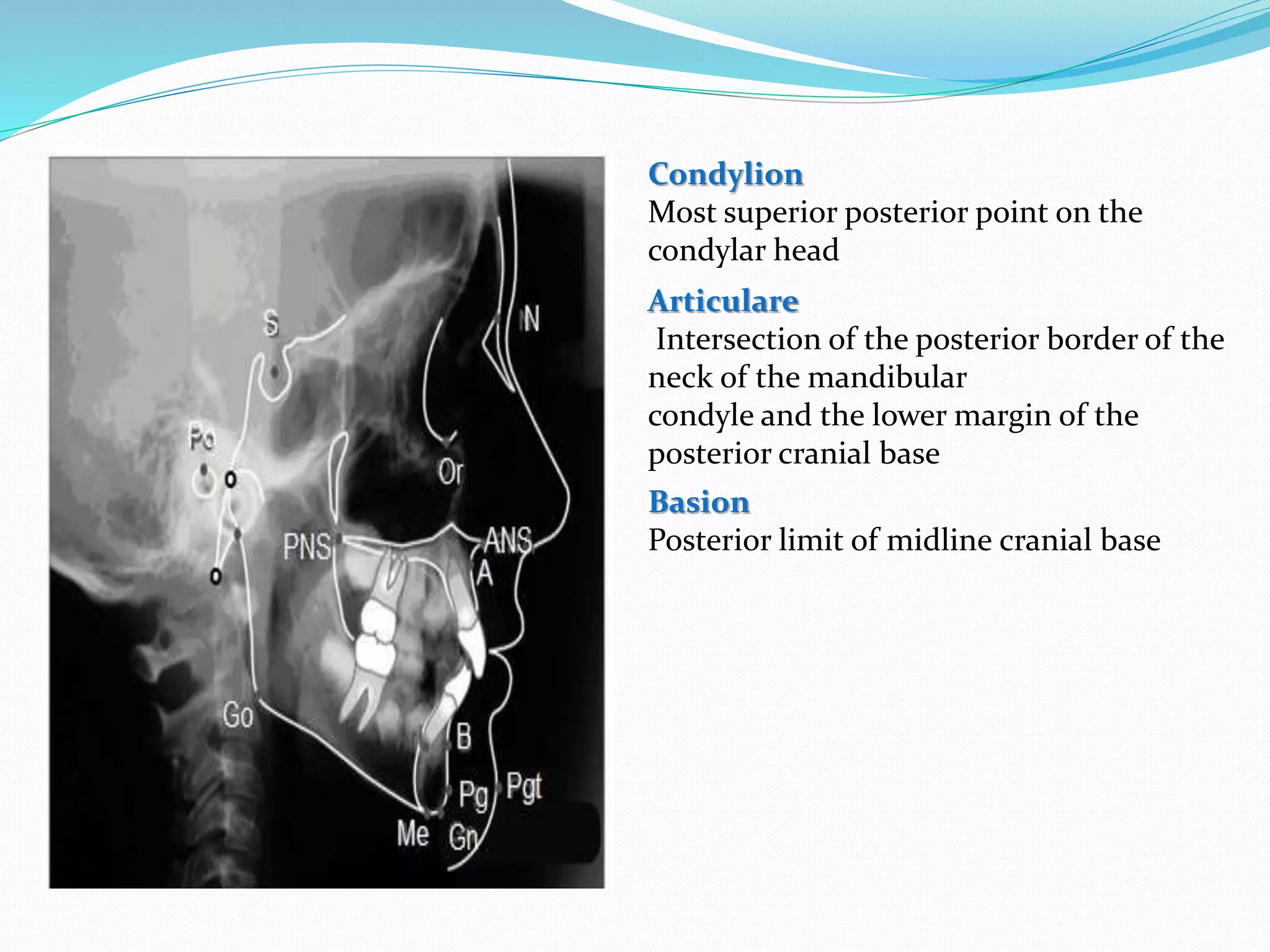 Orthodontic Cephalometric analysis | PPTX