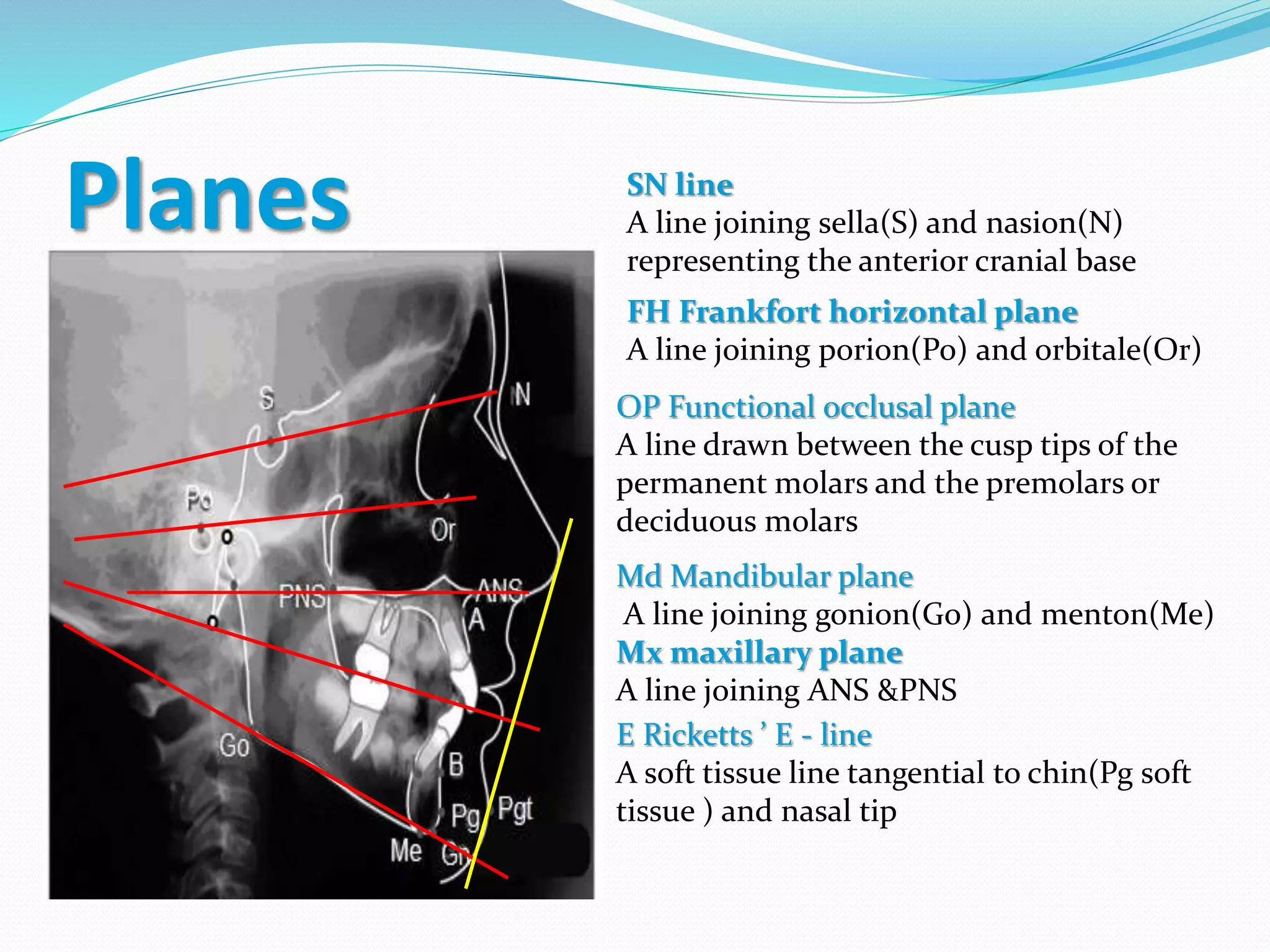 Orthodontic Cephalometric analysis | PPTX