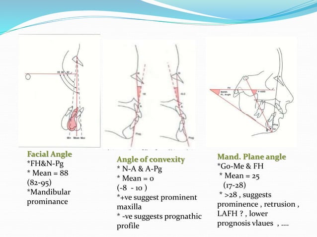 Orthodontic Cephalometric analysis | PPTX