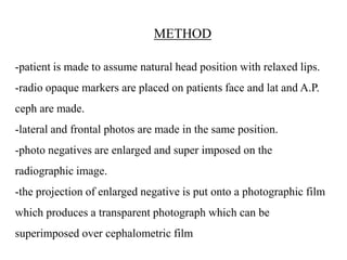 Cephalometric analysis natarajan | PPTX