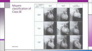 Cephalometric Analysis of discrepancy in Vertical plane | PPTX