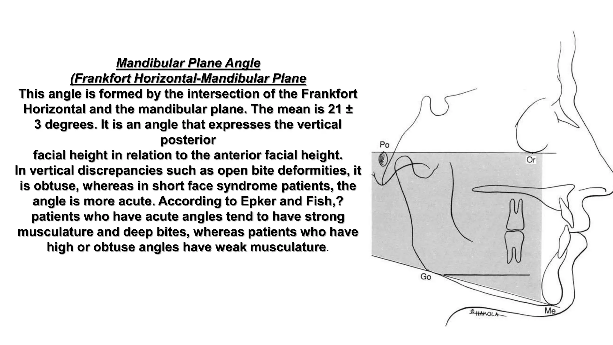 Cephalometric for orthognathic surgery part 1 | PPTX