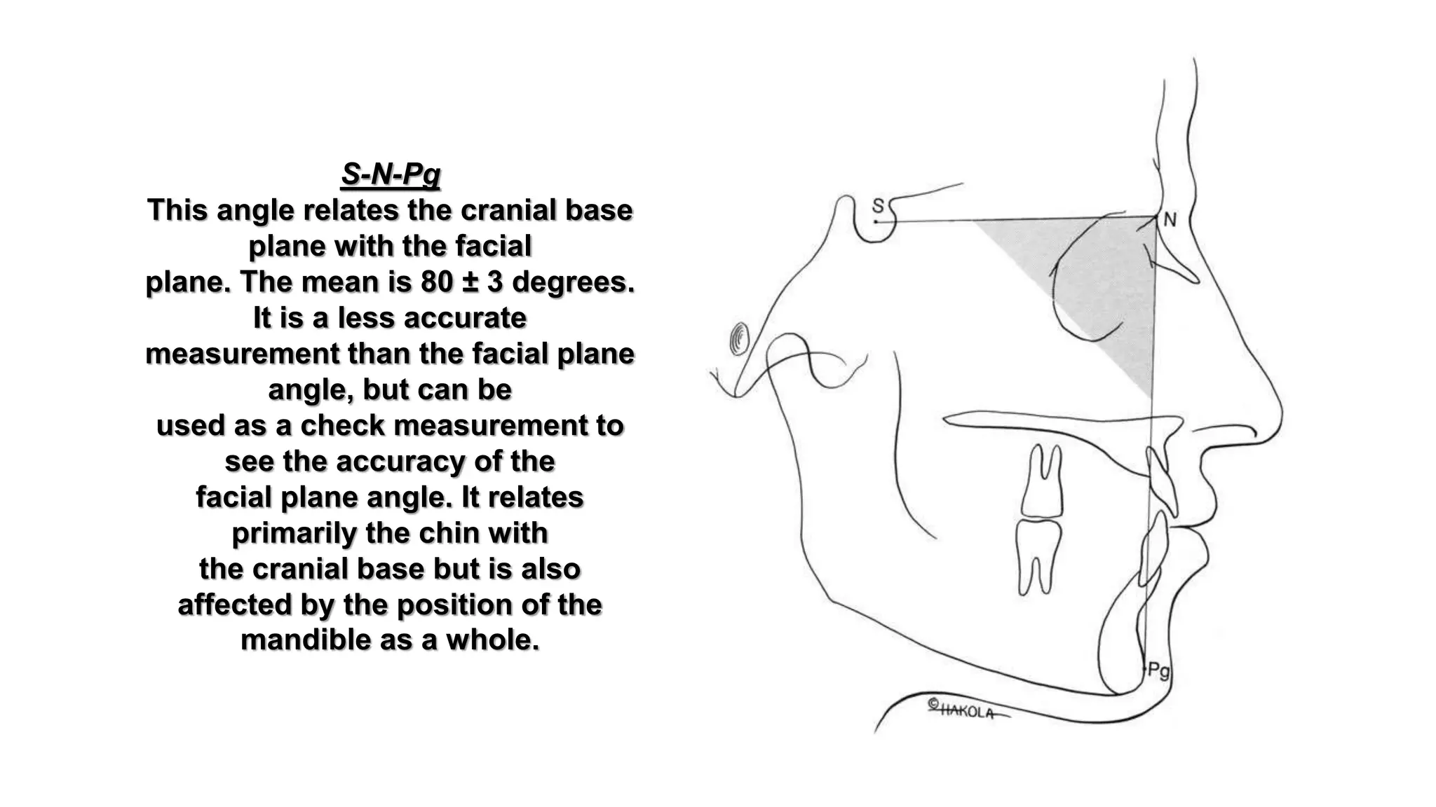 Cephalometric for orthognathic surgery part 1 | PPTX
