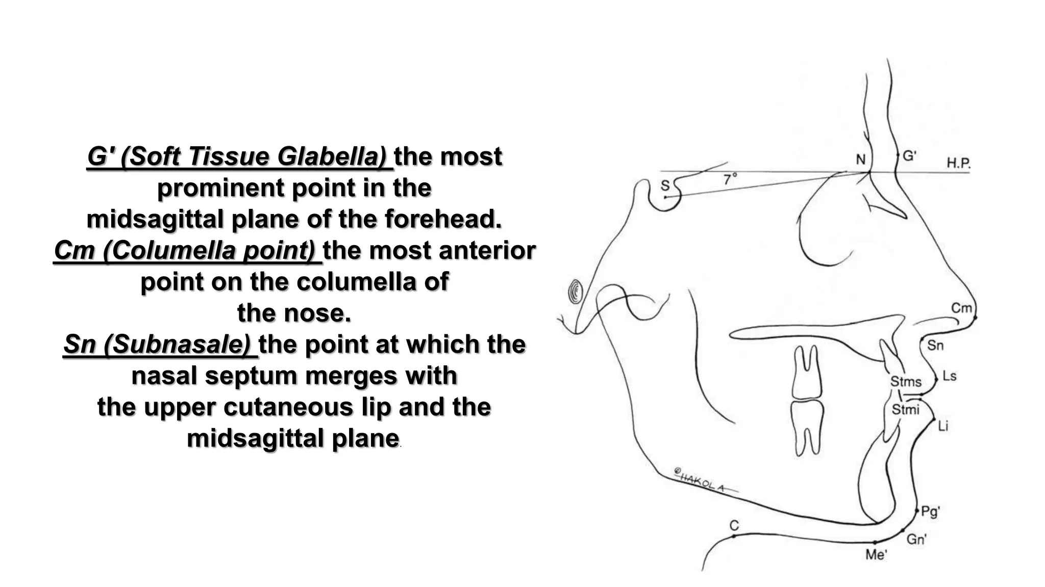 Cephalometric for orthognathic surgery part 1 | PPTX