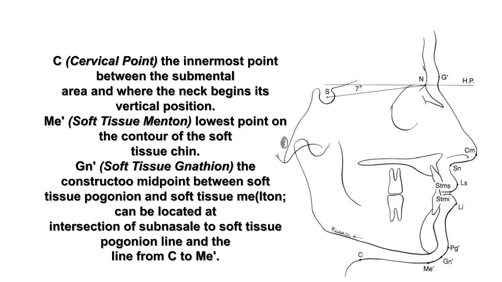 Cephalometric for orthognathic surgery part 1 | PPTX