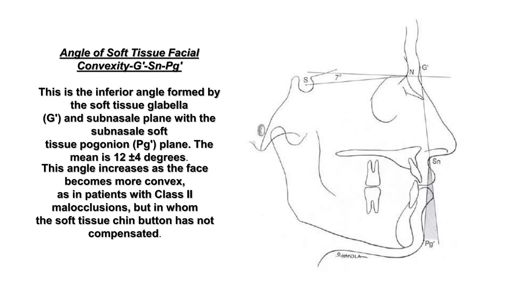 Cephalometric for orthognathic surgery part 1 | PPTX