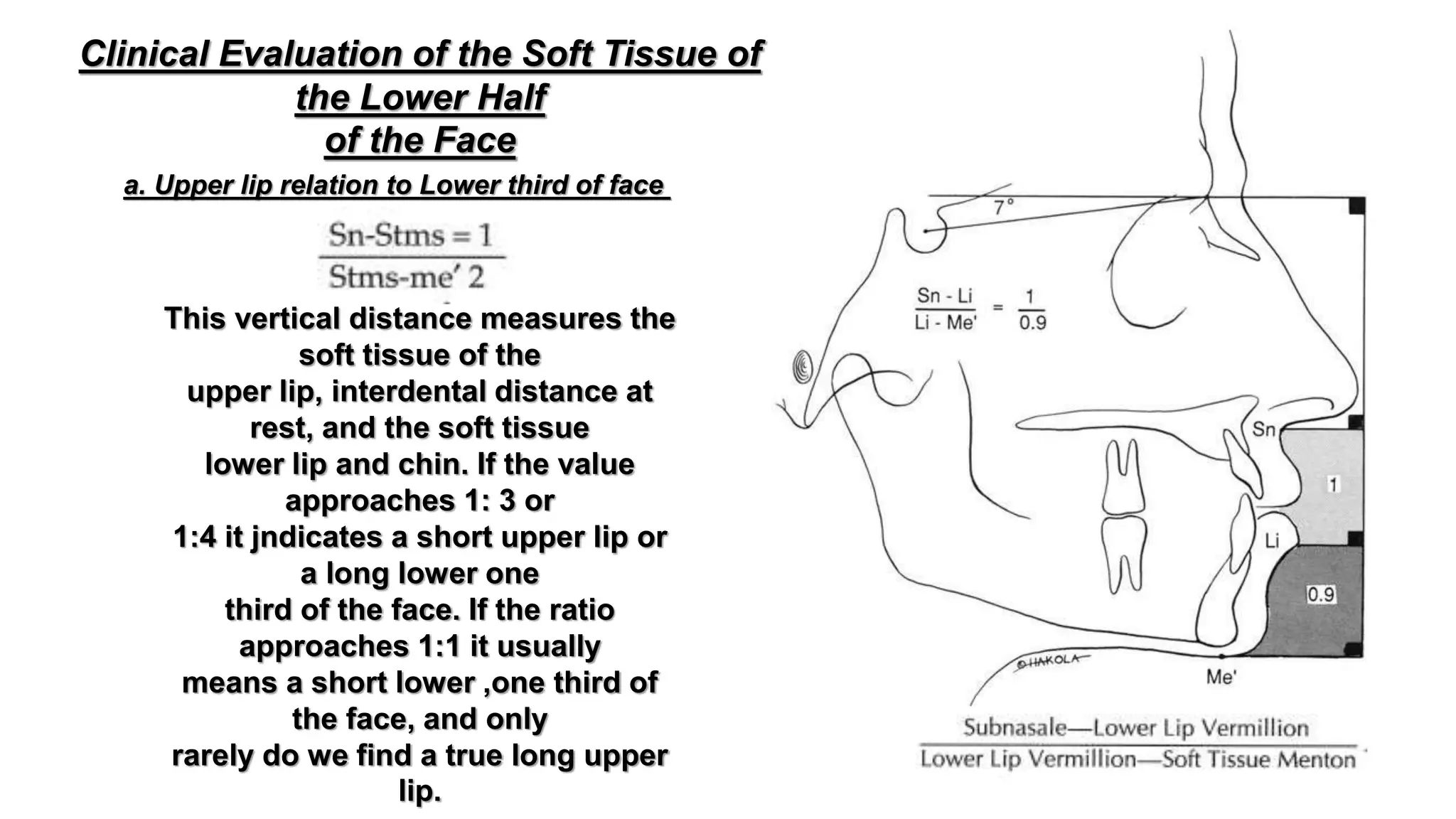 Cephalometric for orthognathic surgery part 1 | PPTX