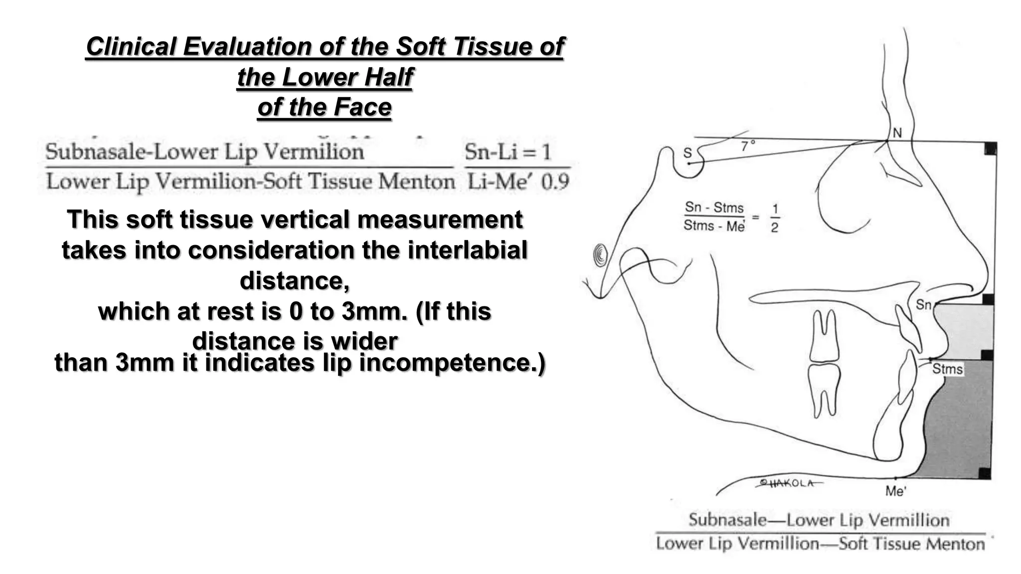 Cephalometric for orthognathic surgery part 1 | PPTX