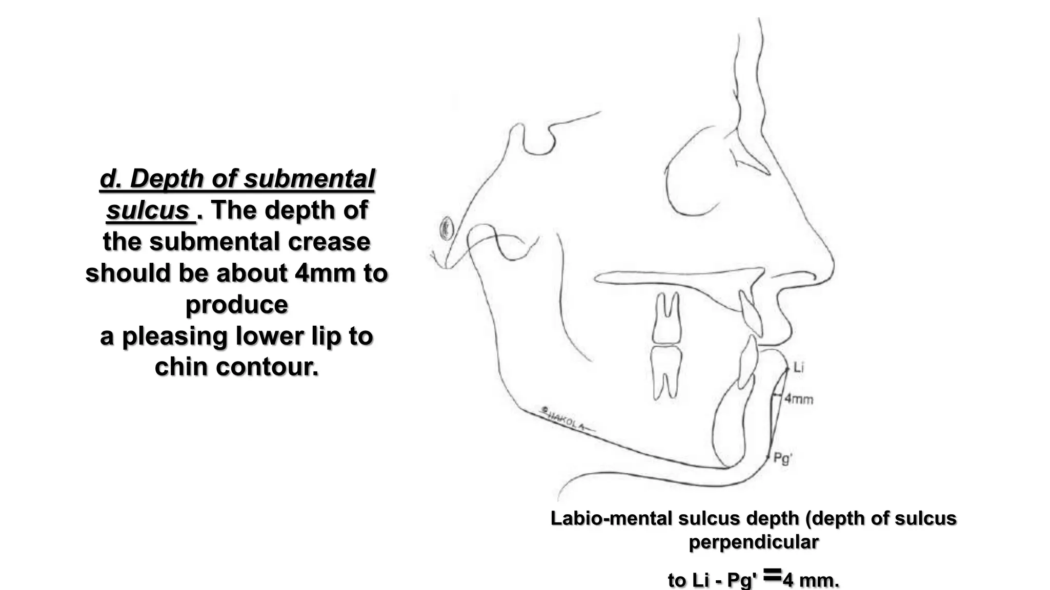 Cephalometric for orthognathic surgery part 1 | PPTX